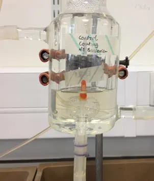 Early warning system for catheter blockages could prevent life ...