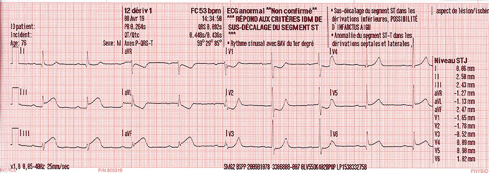 l'ECG : lecture, interprétation, pratique, cas cliniques