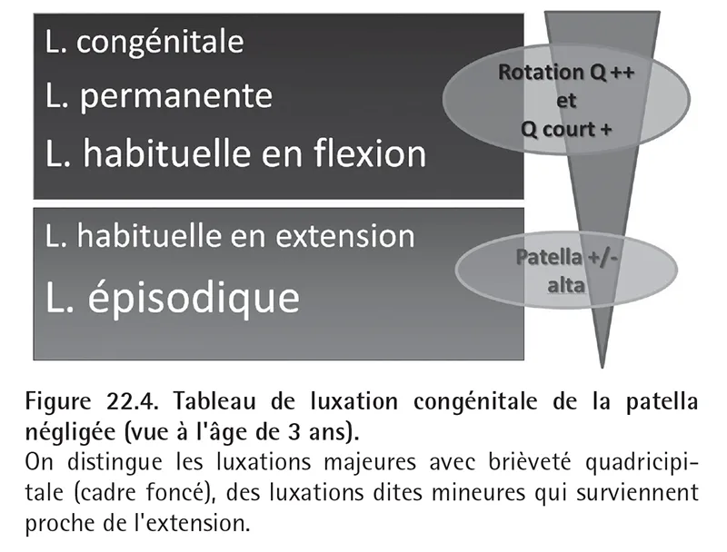 Instabilité Rotulienne chez l'Enfant: Prise en Charge Précoce.
