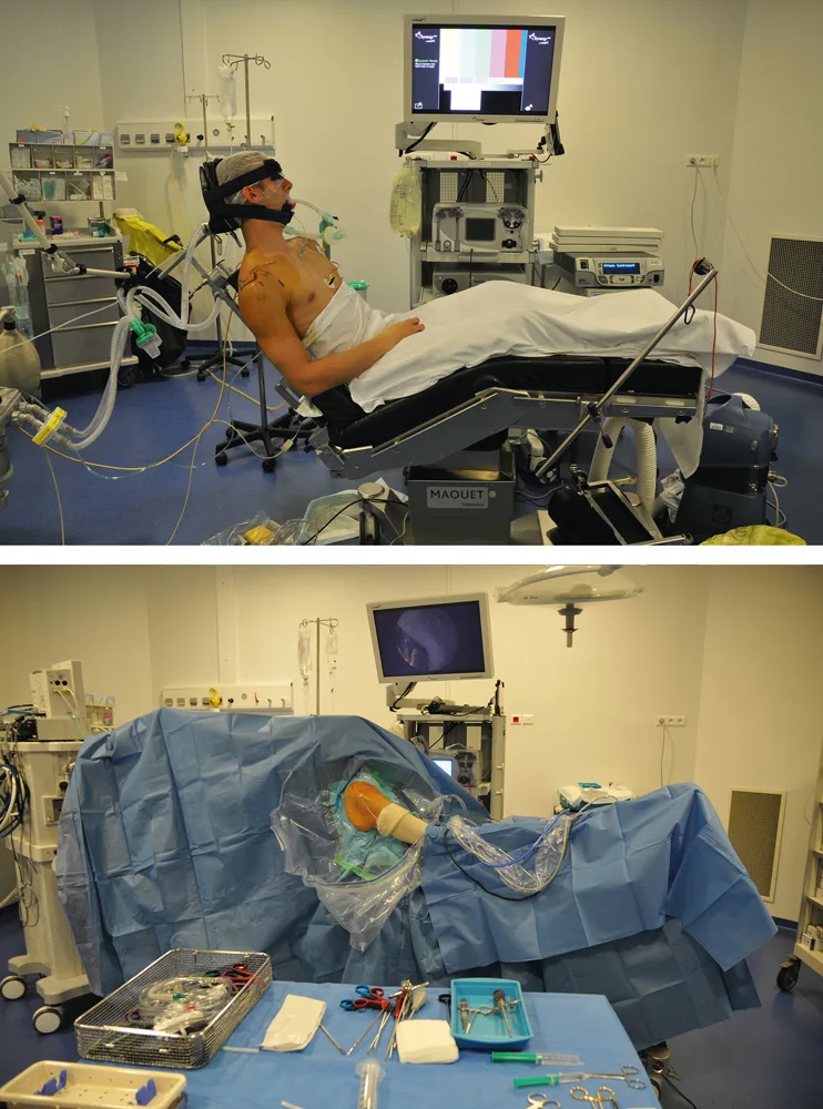 Arthroscopie de l’épaule : installation et voies d’abord