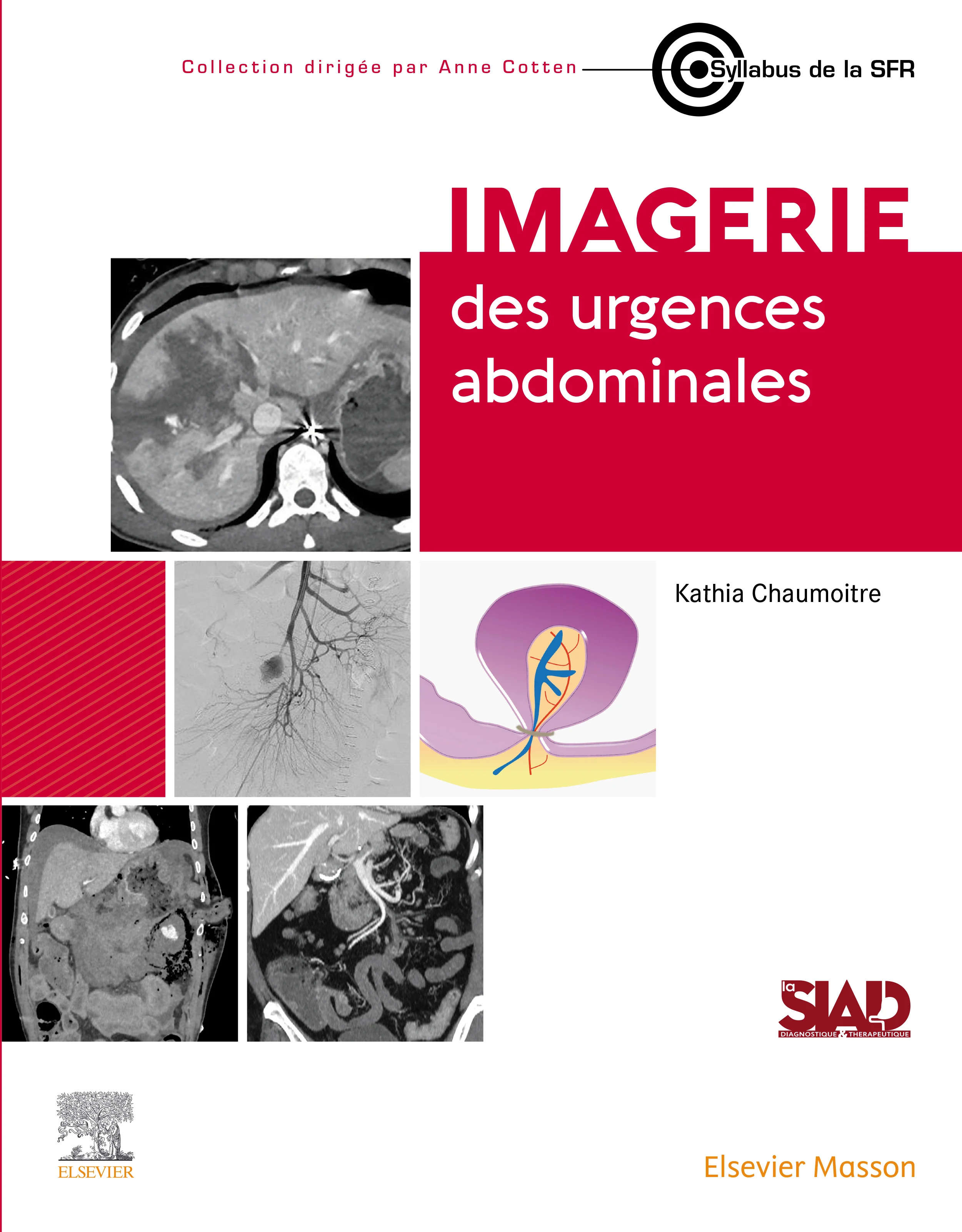 Les Syllabus de la Société Française de Radiologie