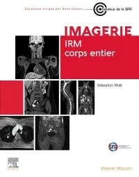 Les Syllabus de la Société Française de Radiologie