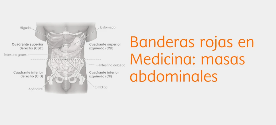Masa abdominal: crecimiento anómalo y sus efectos