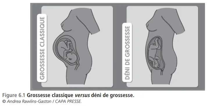 Ca Bouge Dans Mon Ventre Deni De Grossesse