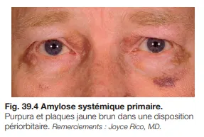 Amylose