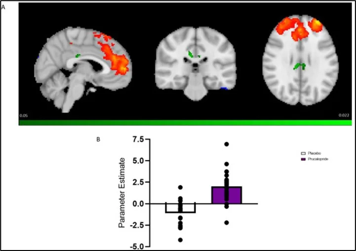 Serotonin booster leads to increased functional brain connectivity | Elsevier