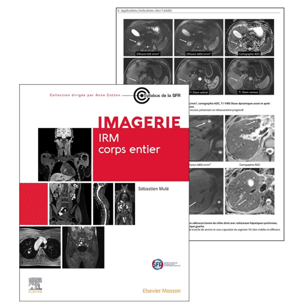 Le premier ouvrage sur l'IRM corps entier, sous l'égide de la SFR.