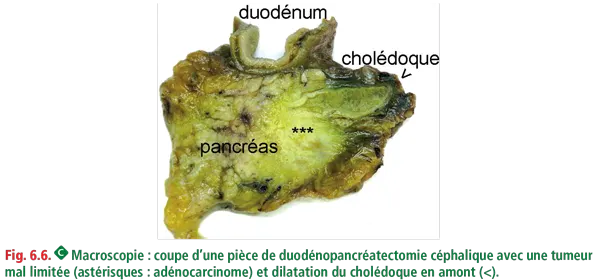 Référentiel Anatomie et cytologie pathologiques édition 2023