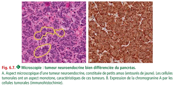 Référentiel Anatomie et cytologie pathologiques édition 2023