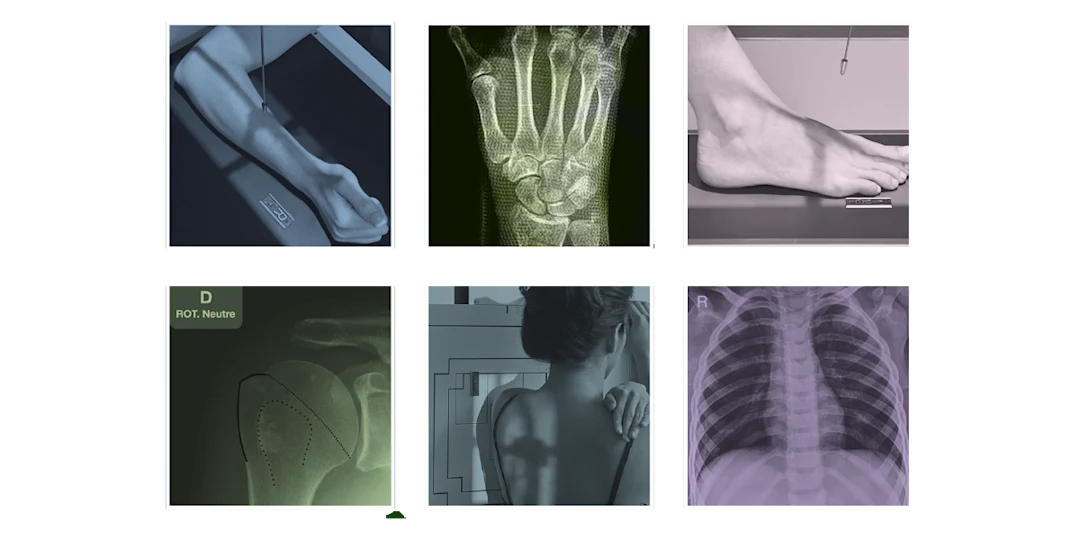 Positions et incidences