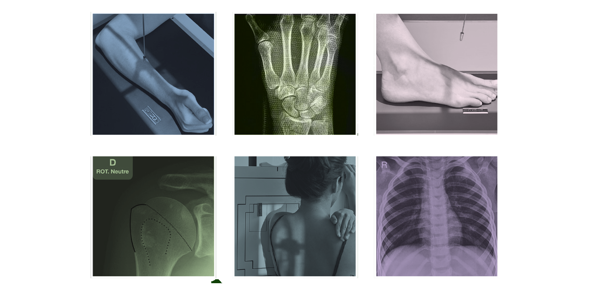 Positions et incidences