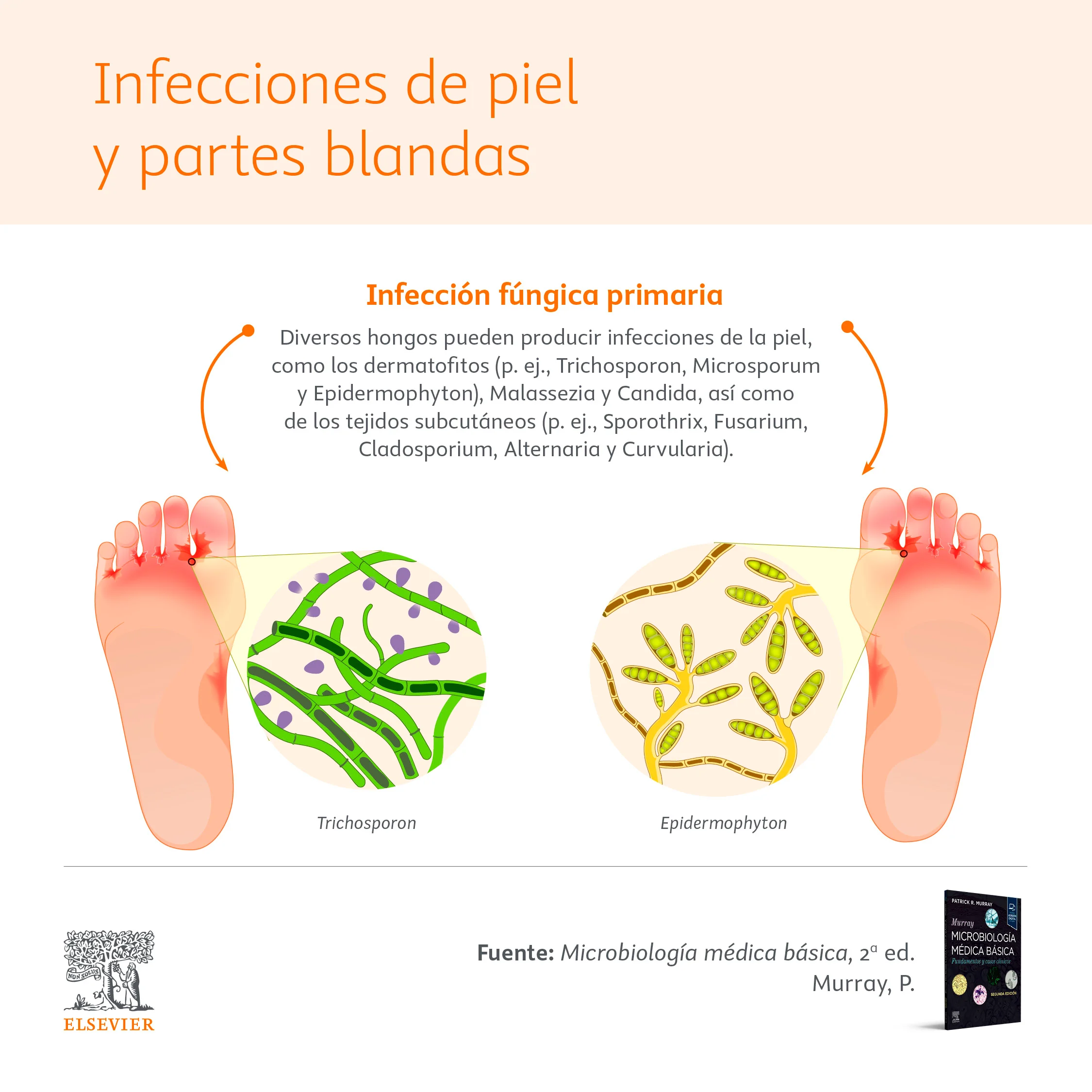 Infecciones de la piel y partes blandas