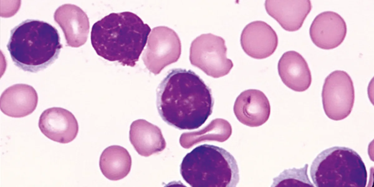 Anatomie et cytologie pathologiques