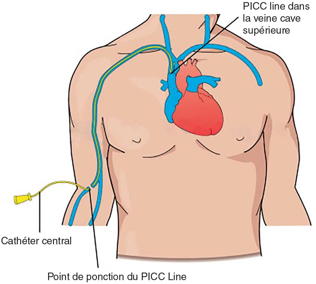 Les molécules de chimiothérapie de A à Z