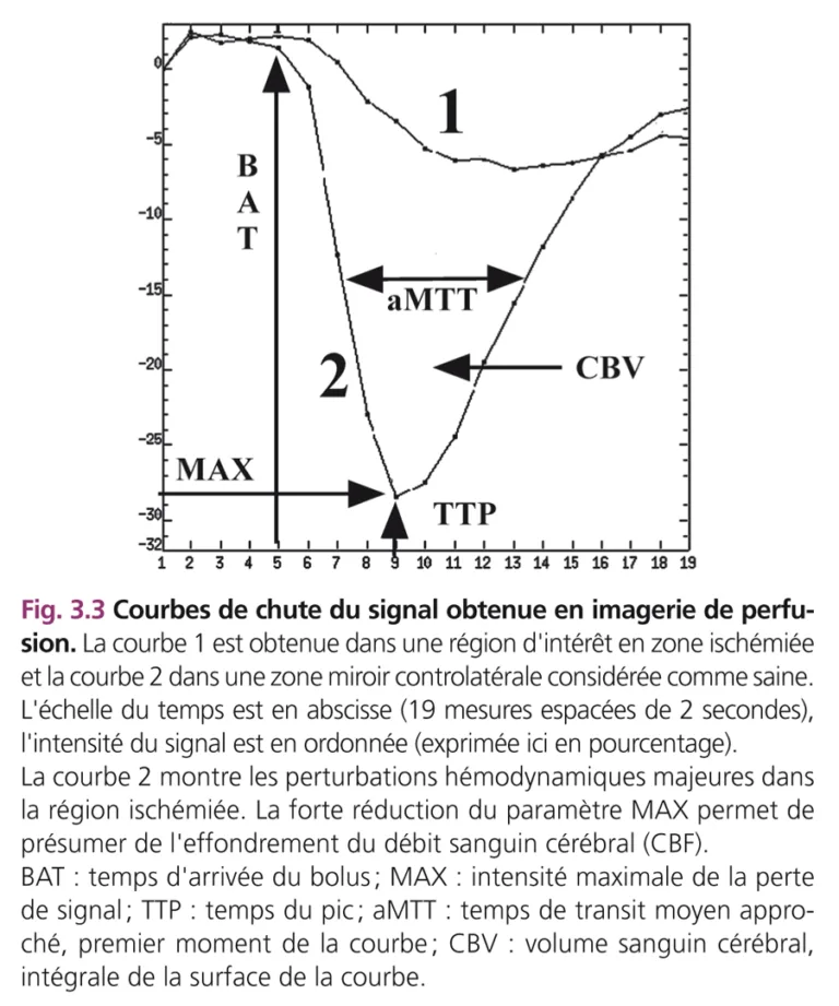 Imageries de diffusion et de perfusion