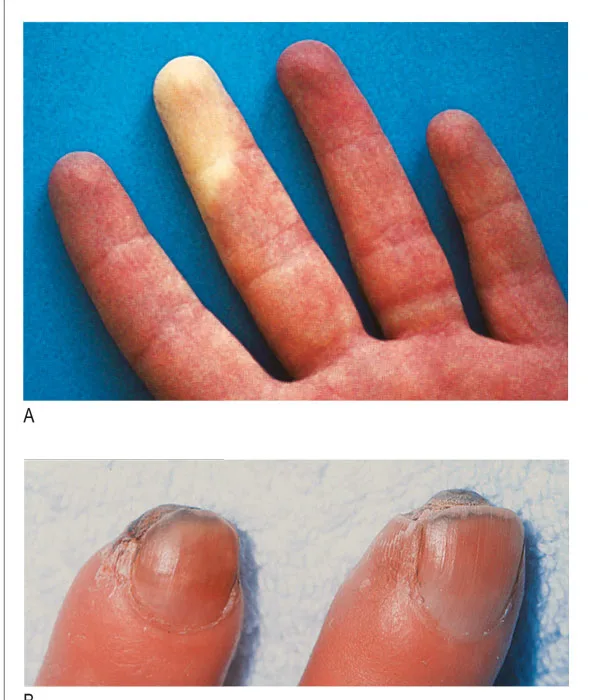 Examen clinique et sémiologie Macleod