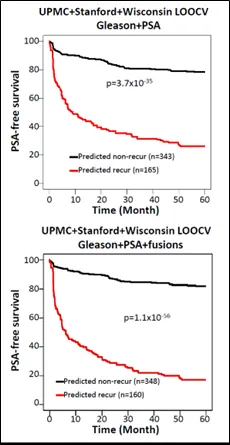 New machine learning model improves prediction of prostate cancer ...