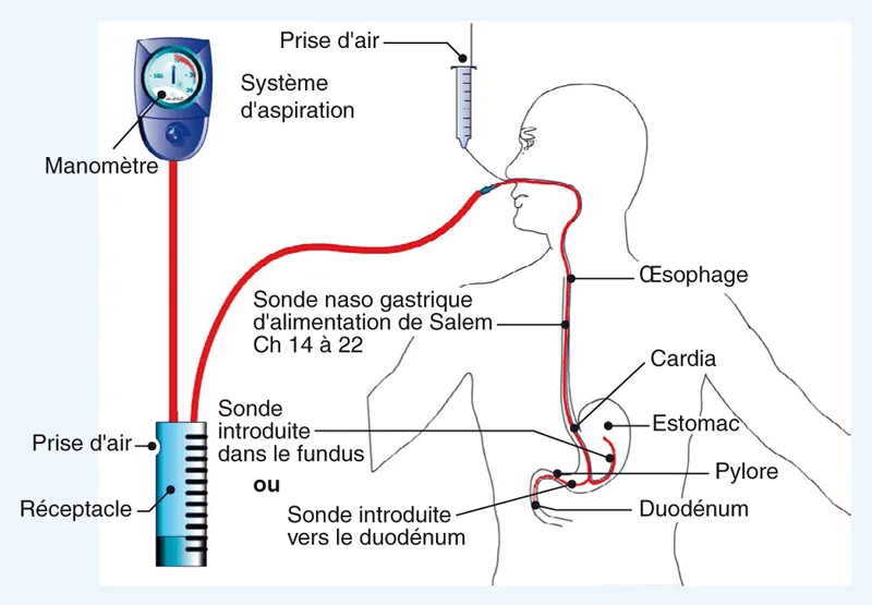 Fiches de soins infirmiers avec séquences filmées