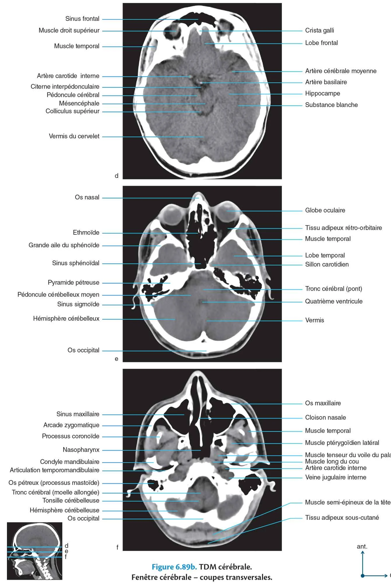 Atlas d'anatomie générale et radiologique