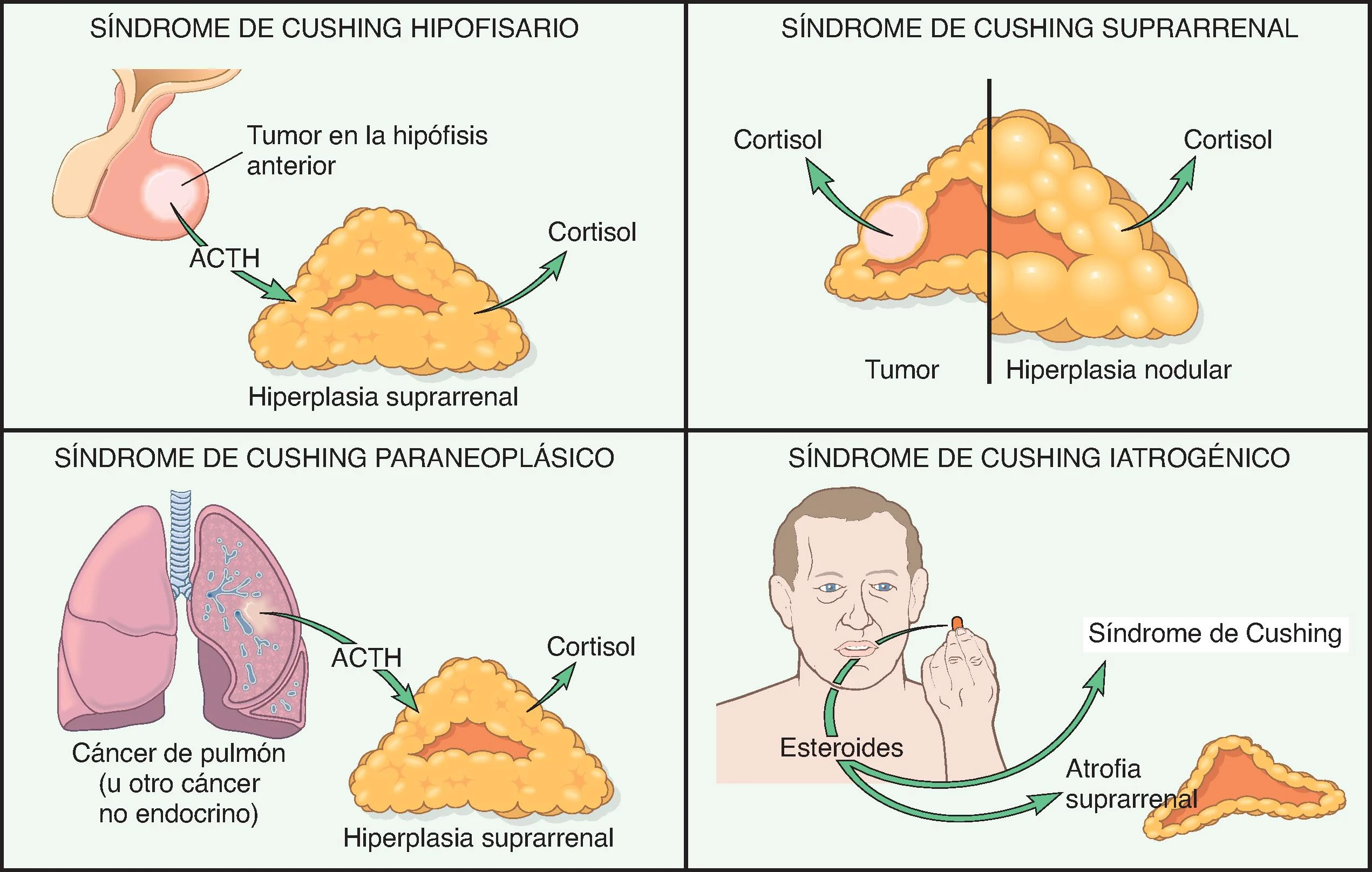Dr. Harvey Cushing: Neurocirujano y Síndrome de Cushing.