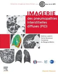 Les Syllabus de la Société Française de Radiologie