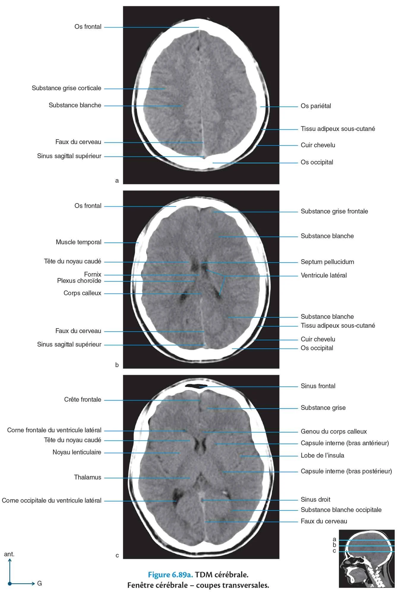 Atlas d'anatomie générale et radiologique