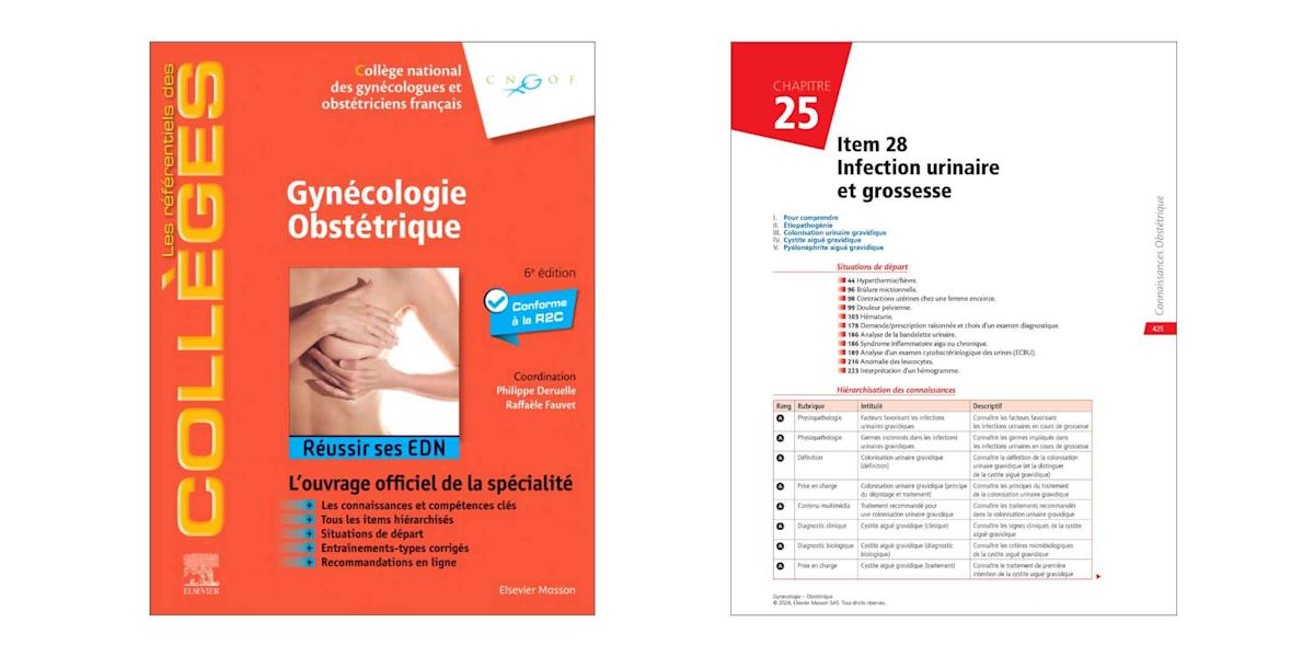 LA référence EDN en Gynécologie-Obstétrique par le Collège CNGOF ...
