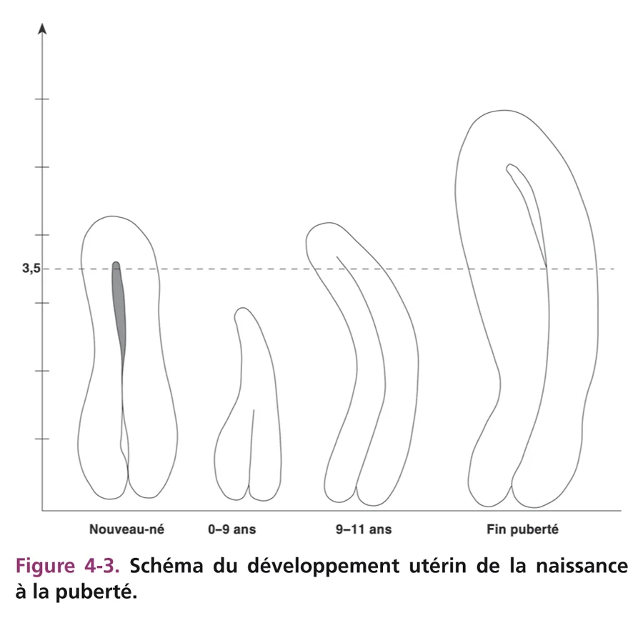 Comment réaliser une Échographie pelvienne de l’enfant et de l ...