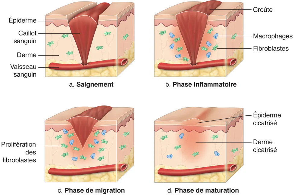 Cicatrisation Efficace : Plaies et Soins