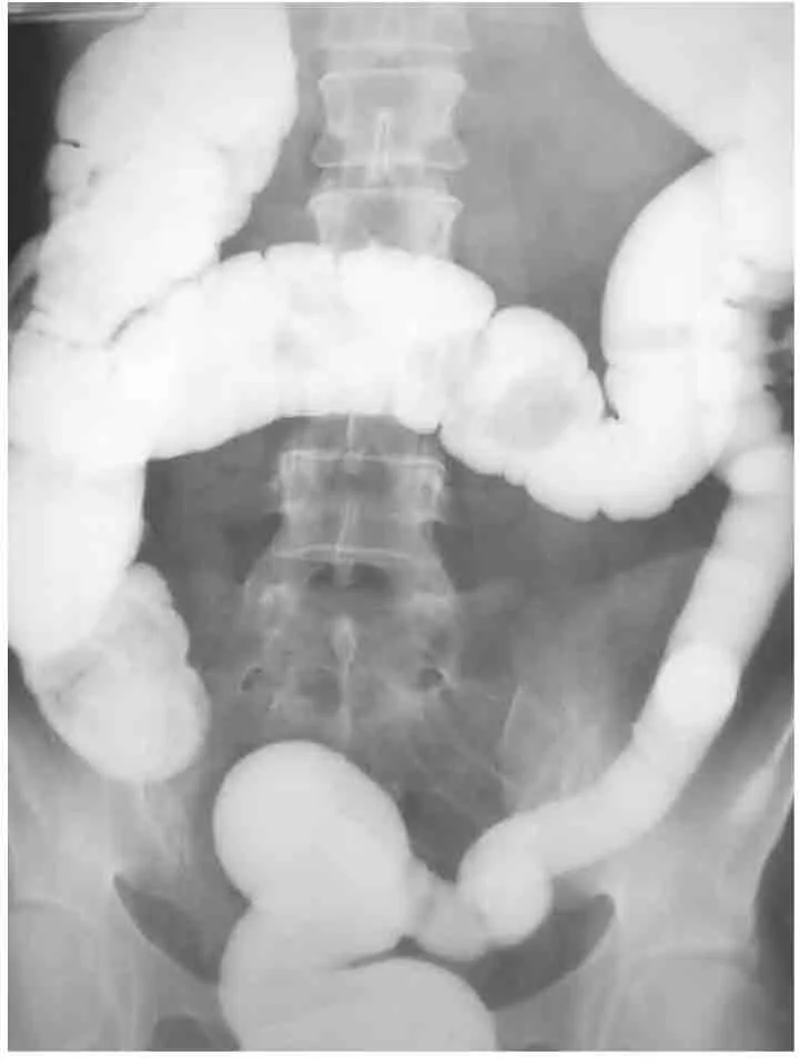 Produits de contraste : Imagerie