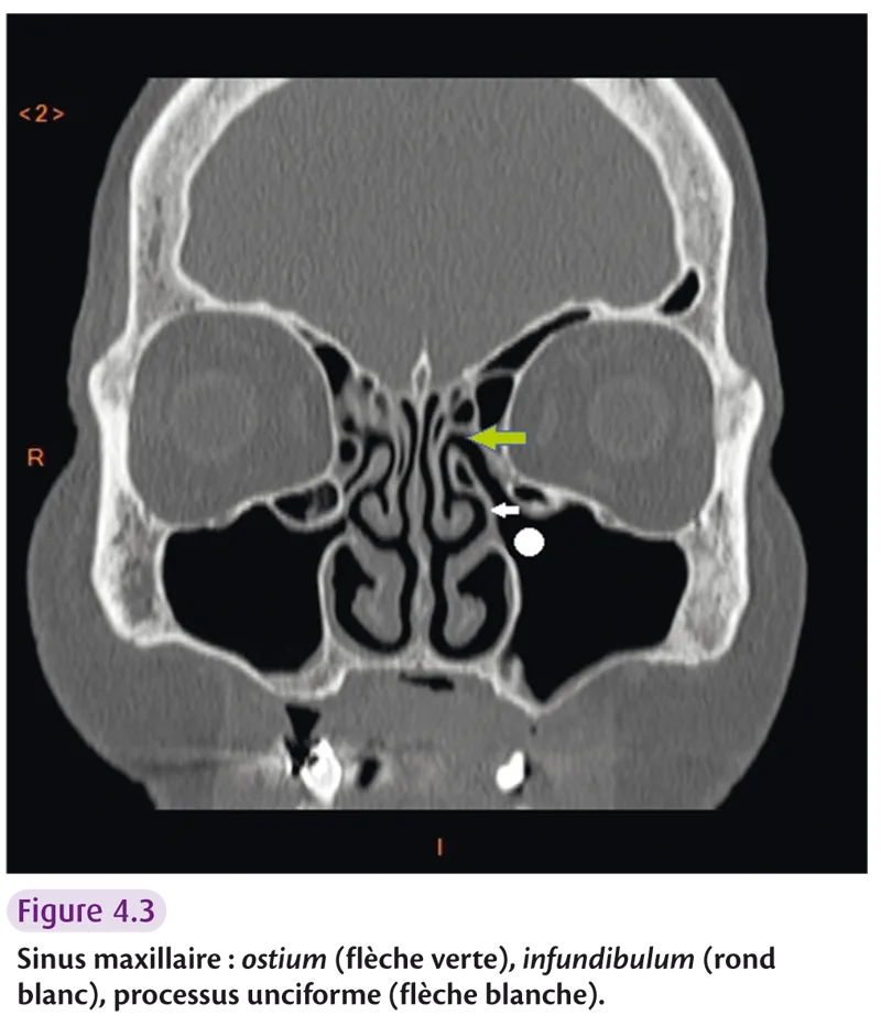 Imageries sinusiennes