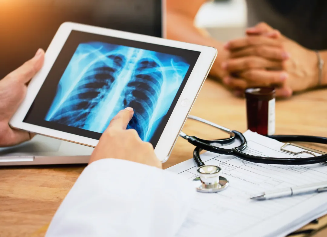 Step Forward: Dr Colin Turner, General Radiologist (South Africa)
