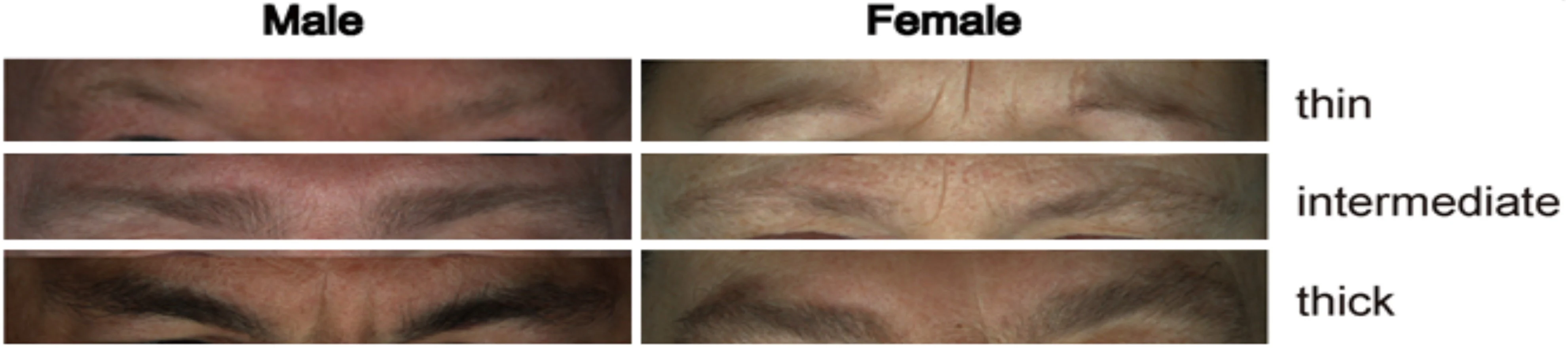 The look of your eyebrows is in your genes | Elsevier