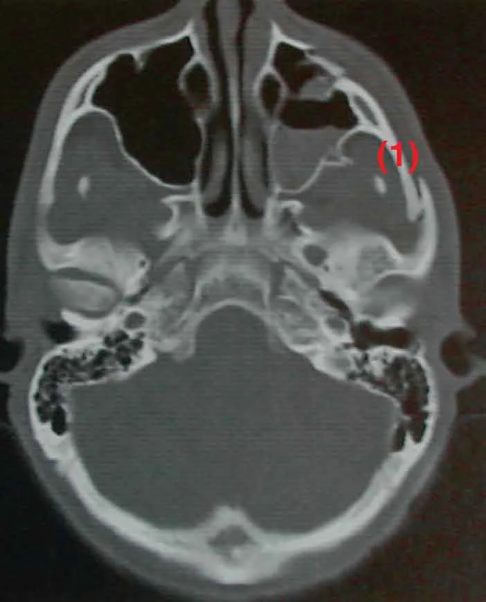 Nouveau Collège CMF édition 2024