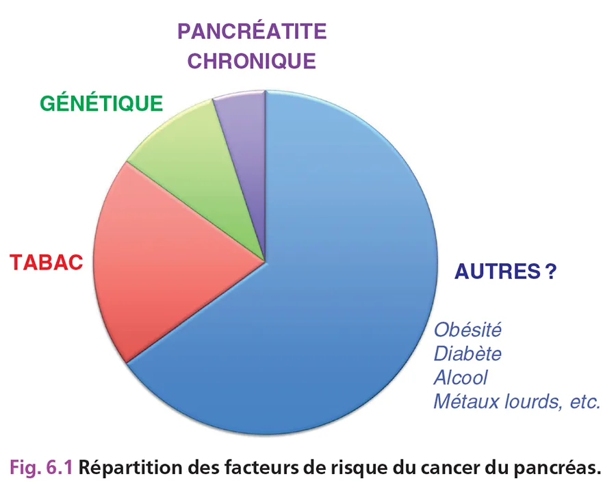 Cancer du pancréas