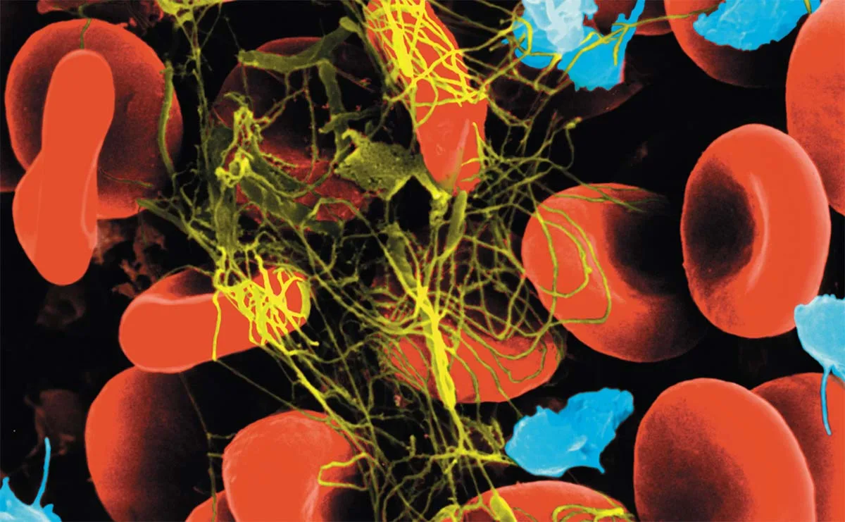 Plaquetas: Funciones esenciales en el cuerpo