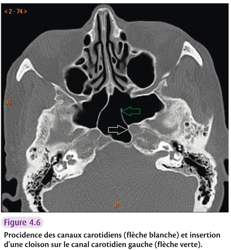 Imageries sinusiennes