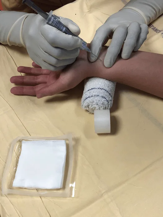 Réalisation d’un gaz du sang artériel