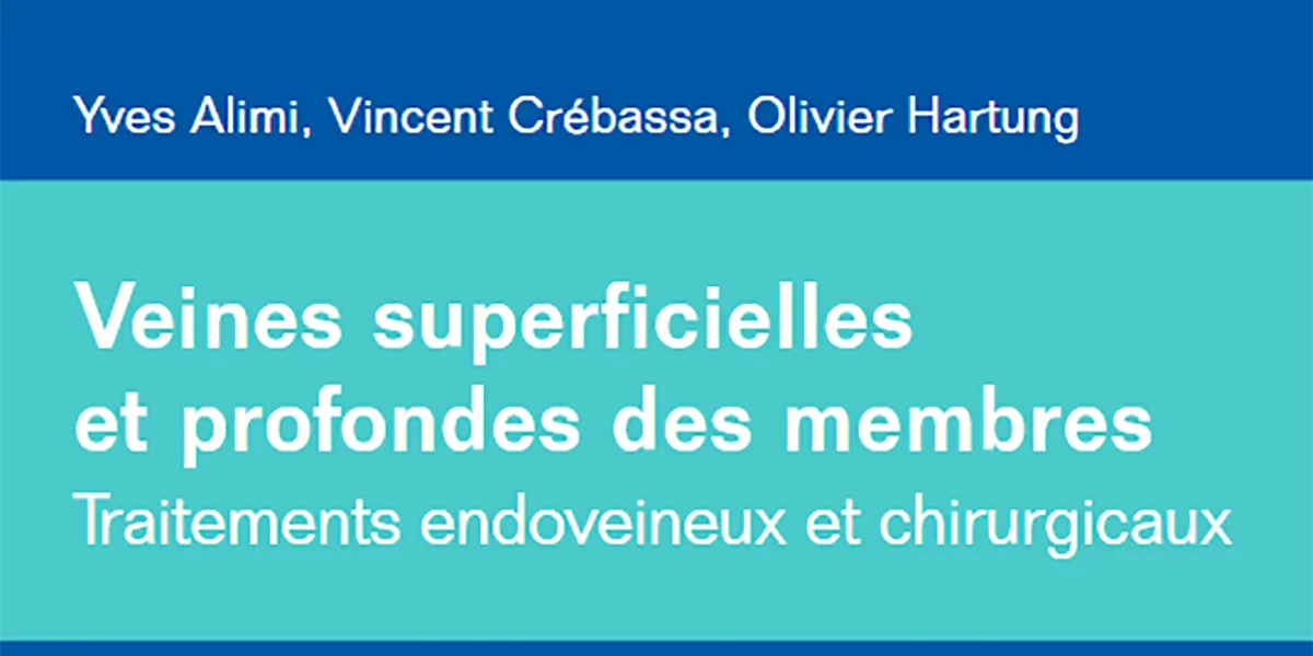 Traitements interventionnels des varices : recommandations et indications