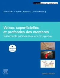 Traitements interventionnels des varices : recommandations et indications