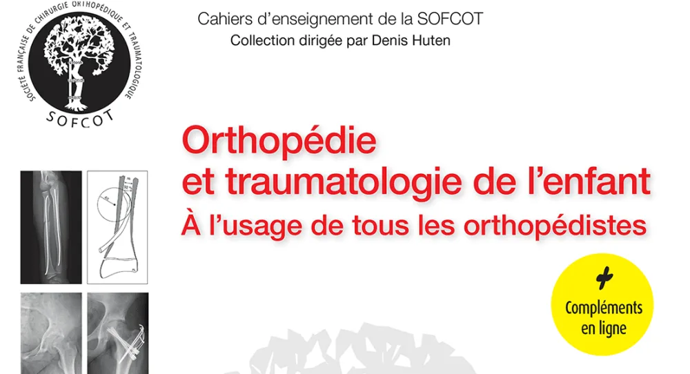 Instabilité Rotulienne chez l'Enfant: Prise en Charge Précoce.