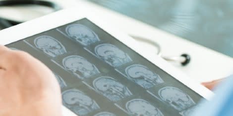 Step forward | Michael Murray, Chelsea and Westminster Hospital